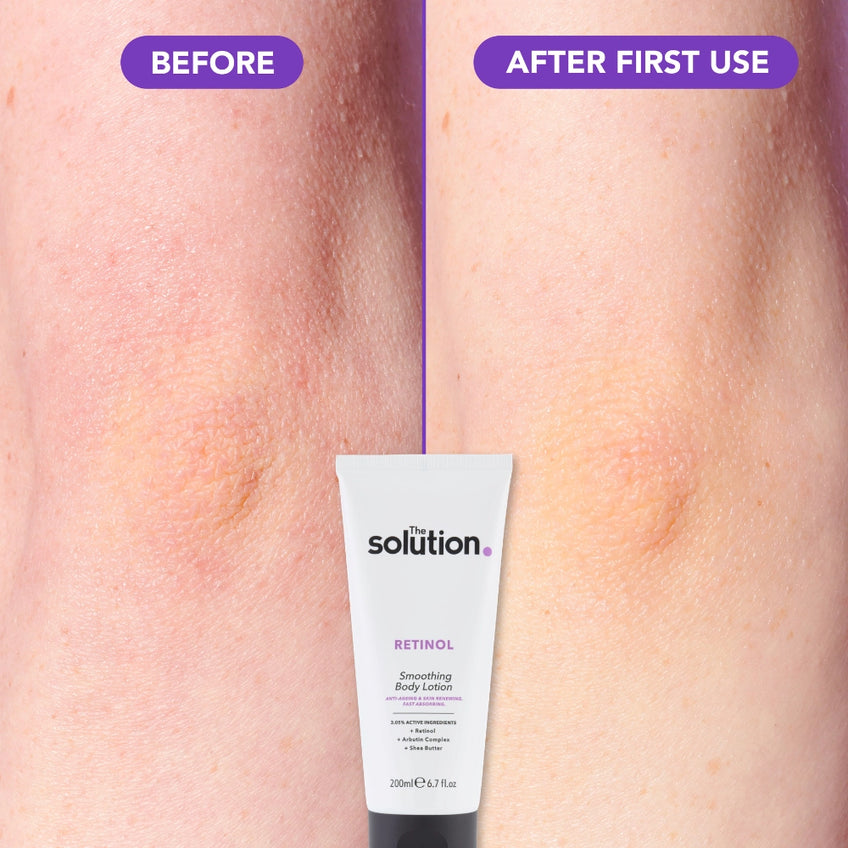 The Solution Retinol Smoothing Body Lotion - Alcedrix