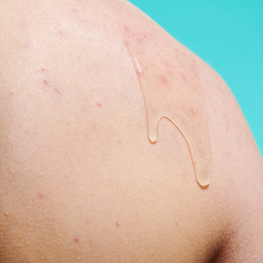 The Solution Salicylic Acid Clear Skin Body Gel - Alcedrix